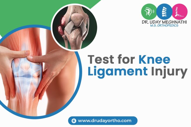 Test for Knee Injury | Knee Ligament Injury Treatment