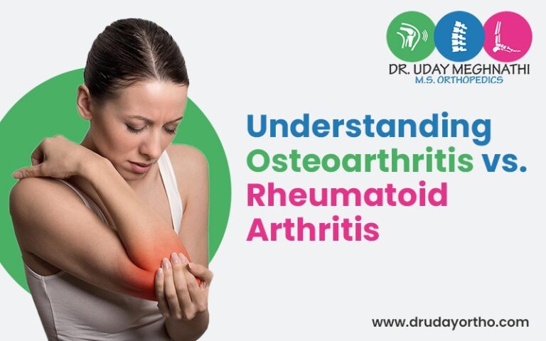 Understanding Osteoarthritis vs. Rheumatoid Arthritis