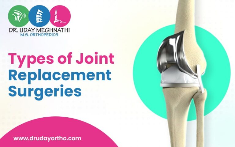 Types of Joint Replacement Surgeries | Hip, Knee, Shoulder