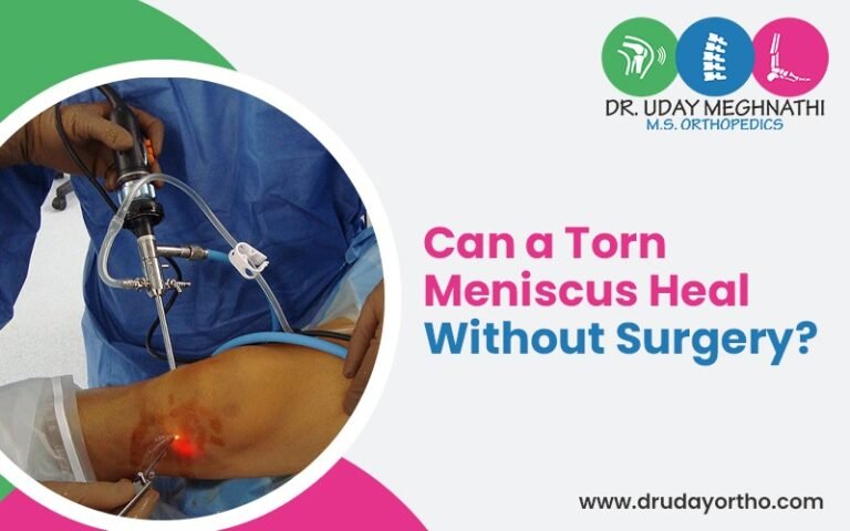 Can a Torn Meniscus Heal Without Surgery?