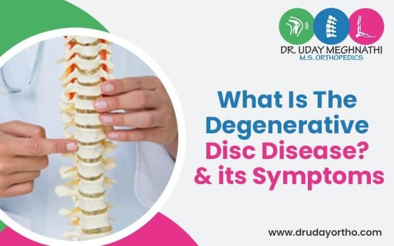 Degenerative Disc Disease: Causes, Symptoms, Treatment Options