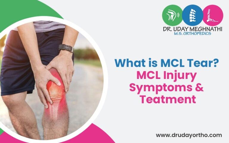 What is an MCL Tear? - Symptoms, Causes, Treatment